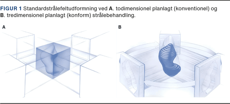 Strålebehandling af ældre patienter med kræft | Ugeskriftet.dk