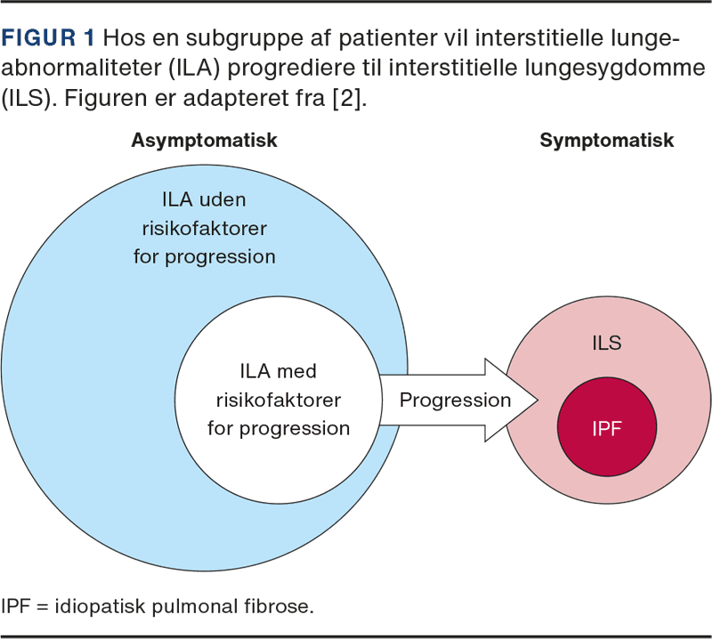 Identifikation og håndtering af interstitielle lungeabnormaliteter | Ugeskriftet.dk