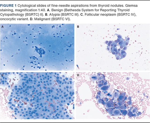 Validation of the Bethesda System for Reporting Thyroid Cytopathology in a Danish tertiary ...