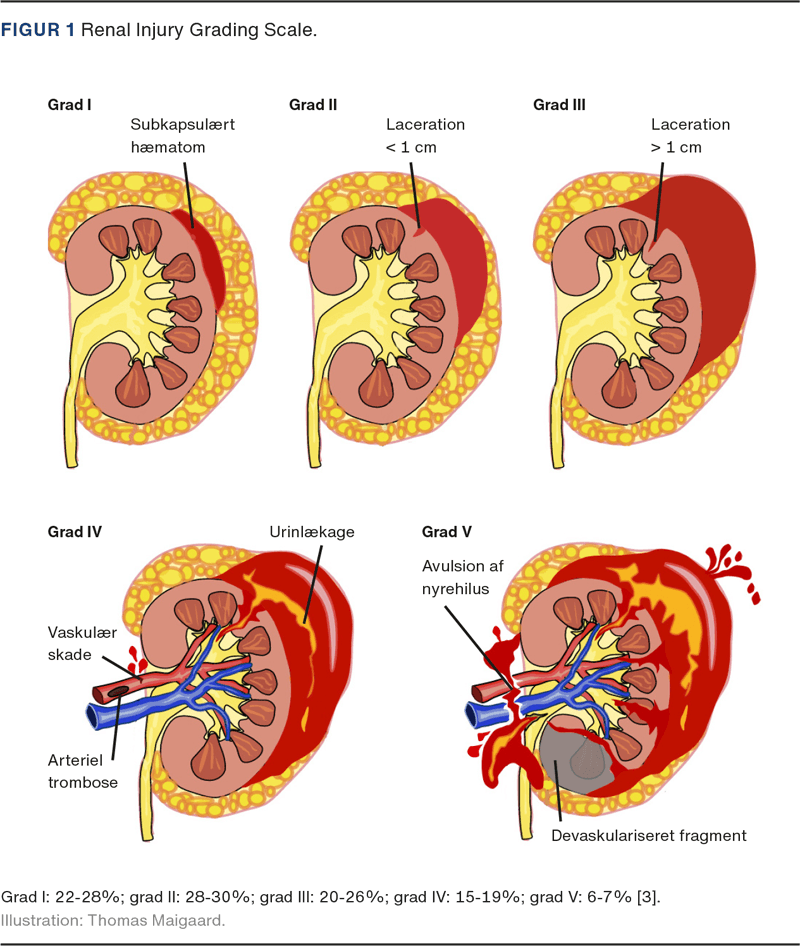 Akutte urologiske traumer | Ugeskriftet.dk