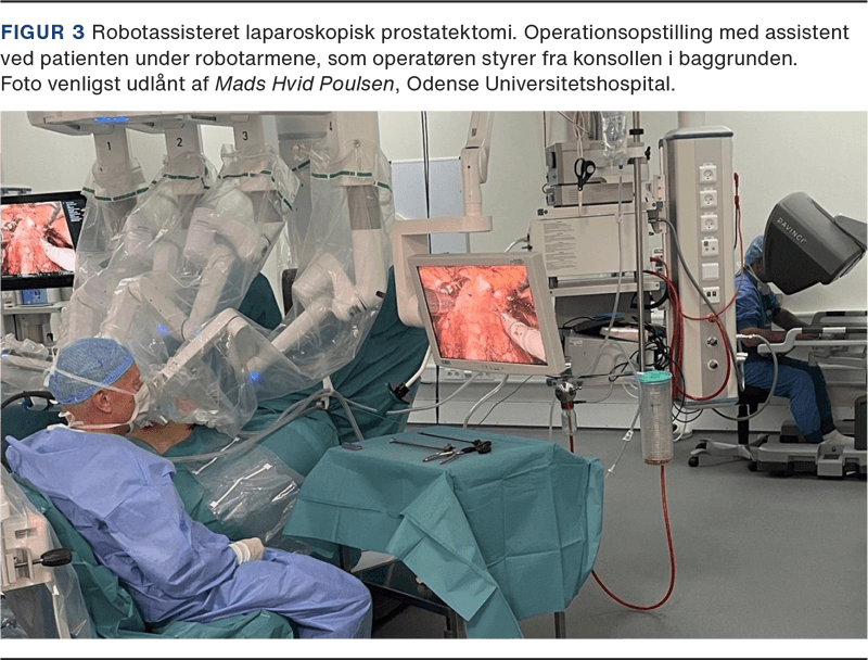 Prostatakræft | Ugeskriftet.dk