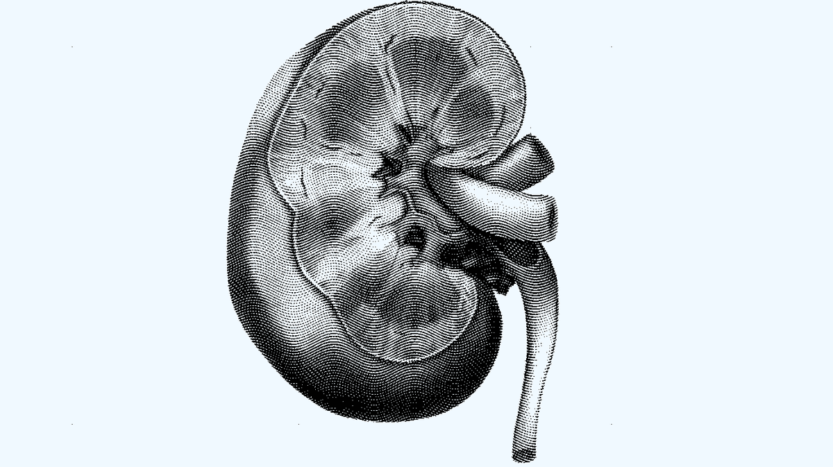 Akut nyresvigt hos 15-årig efter kortvarigt brug af NSAID | Ugeskriftet.dk
