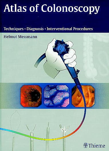 Atlas of colonoscopy. Techniques, diagnosis, interventional procedure ...