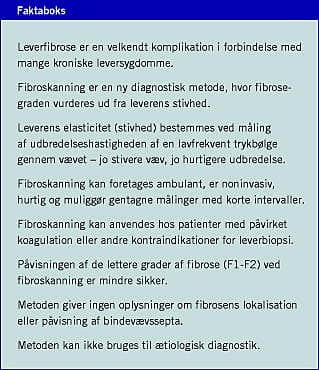 Fibroskanning til diagnostik af leverfibrose | Ugeskriftet.dk