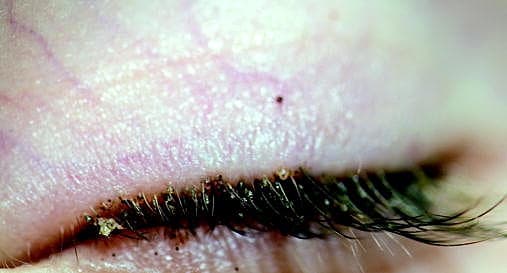 Månedens billede | Ugeskriftet.dk