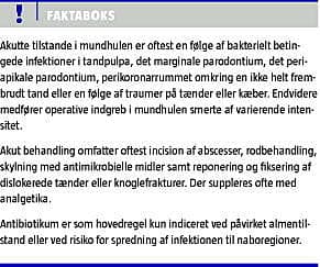 Akutte tilstande i mundhulen | Ugeskriftet.dk