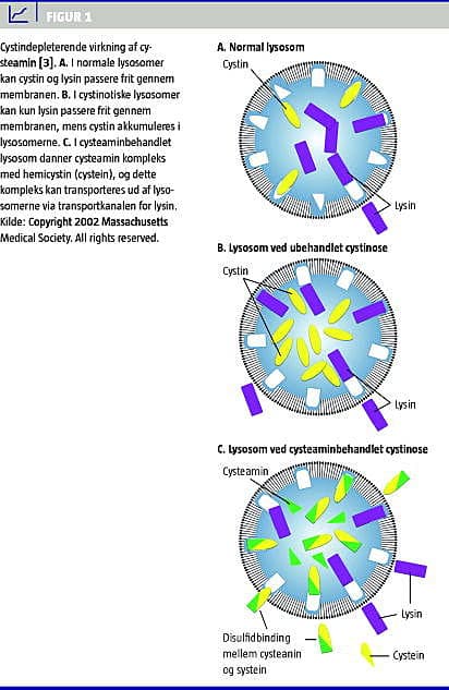 Bedre prognose af cystinose ved behandling med cysteamin og ...