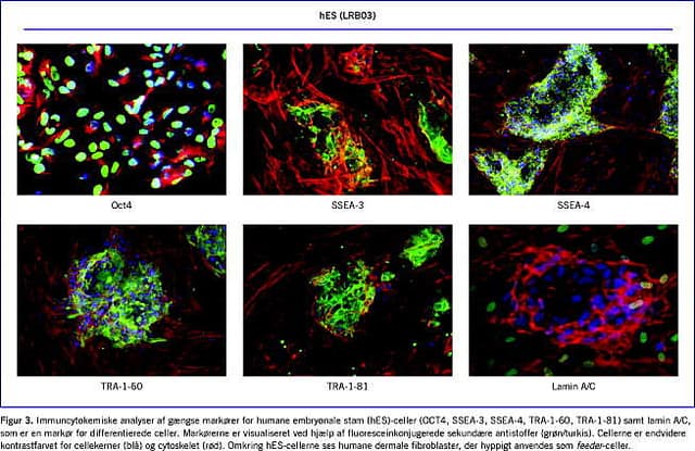 Humane embryonale stamceller: potentiale og aktuelle udfordringer ...