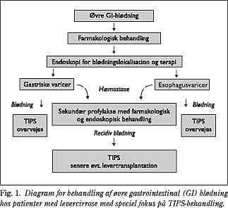 Transjugulær intrahepatisk portosystemisk shunt (TIPS) til behandling ...