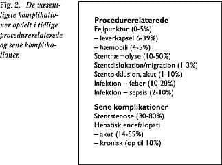 Transjugulær intrahepatisk portosystemisk shunt (TIPS) til behandling ...