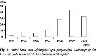 Lejringsbetinget plagiocefali | Ugeskriftet.dk