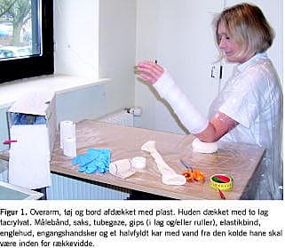 Bandagering af håndled | Ugeskriftet.dk