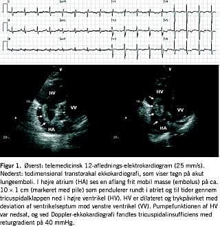 Telemedicinsk præhospital diagnostik og visitation af en patient med ...