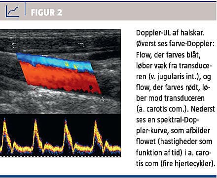 UL-skanning med fokus på bløddelsforandringer | Ugeskriftet.dk