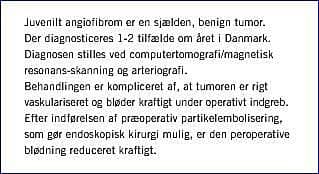 Juvenile angiofibromer | Ugeskriftet.dk