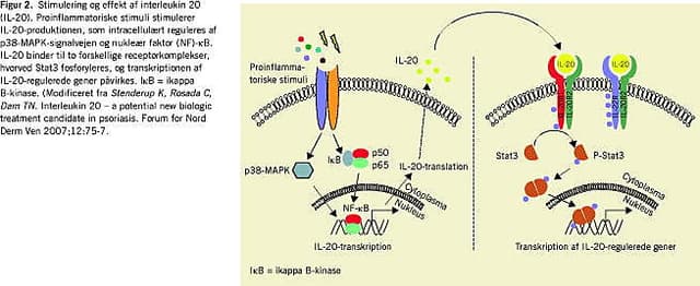 Interleukin 20 - et nyt mål for psoriasisbehandling | Ugeskriftet.dk