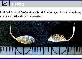 Et dansk tilfælde af intestinal pseudomyiasis forårsaget af Eristalis ...
