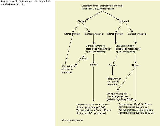 Prænatalt diagnosticeret hydronefrose og andre urologiske anomalier ...