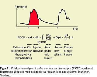 Kredsløbsmonitorering af kritisk syge patienter med »pulse contour ...