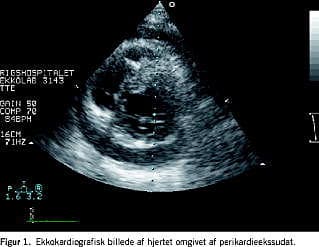 Intensiv hjerte- og thoraxterapi - status på området | Ugeskriftet.dk