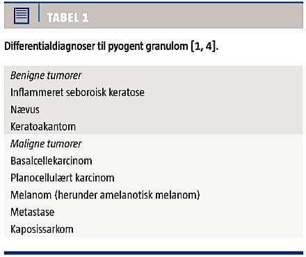 Pyogent granulom | Ugeskriftet.dk
