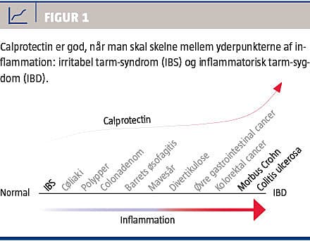 Fækal calprotectin er en klinisk anvendelig markør for intestinal ...