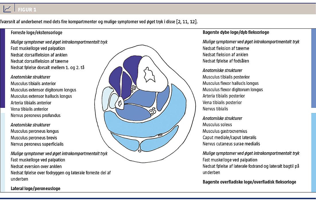 Aktivitetsudløst kronisk kompartmentsyndrom i underbenet | Ugeskriftet.dk