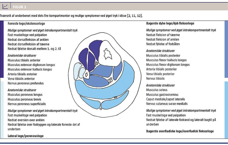 Aktivitetsudløst kronisk kompartmentsyndrom i underbenet | Ugeskriftet.dk