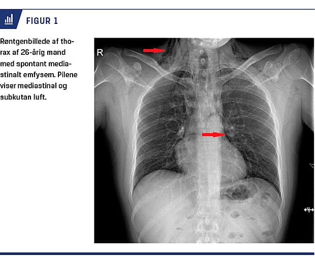 Spontant mediastinalt emfysem | Ugeskriftet.dk