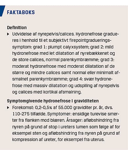 Diagnose og behandling af symptomgivende hydronefrose i graviditeten ...
