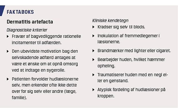 Dermatitis artefacta | Ugeskriftet.dk