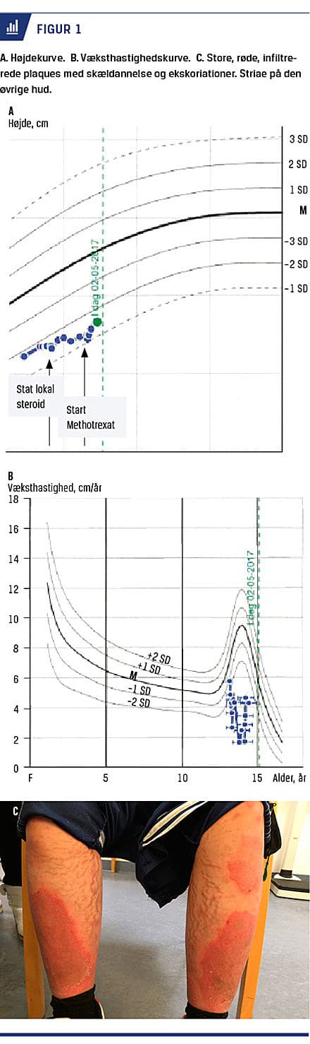 Receptgennemgang i fælles medicinkort- online hos en adipøs dreng med ...