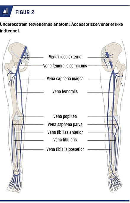 Ultralydskanning er førstevalg ved mistanke om kronisk venesygdom i ...