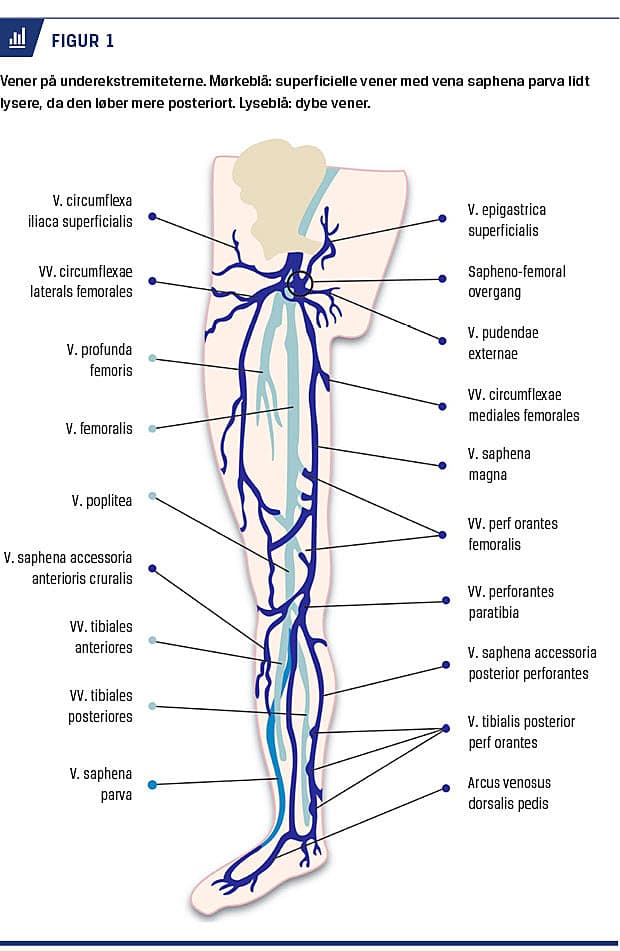 Diagnostik og behandling af superficiel venøs trombose | Ugeskriftet.dk