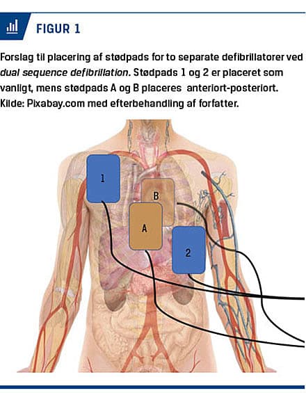 Nye behandlinger til patienter med hjertestop | Ugeskriftet.dk