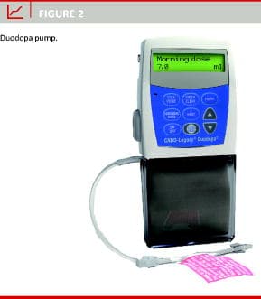 Duodopa pump treatment in patients with advanced Parkinson‘s disease | Ugeskriftet.dk