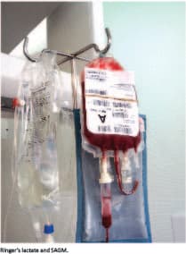 High dosage of dextran 70 is associated with severe bleeding in ...