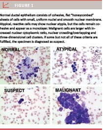 Endoscopic brush cytology from the biliary duct system is still ...