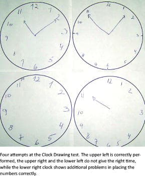 Simple scoring of the Clock-Drawing Test for dementia screening ...