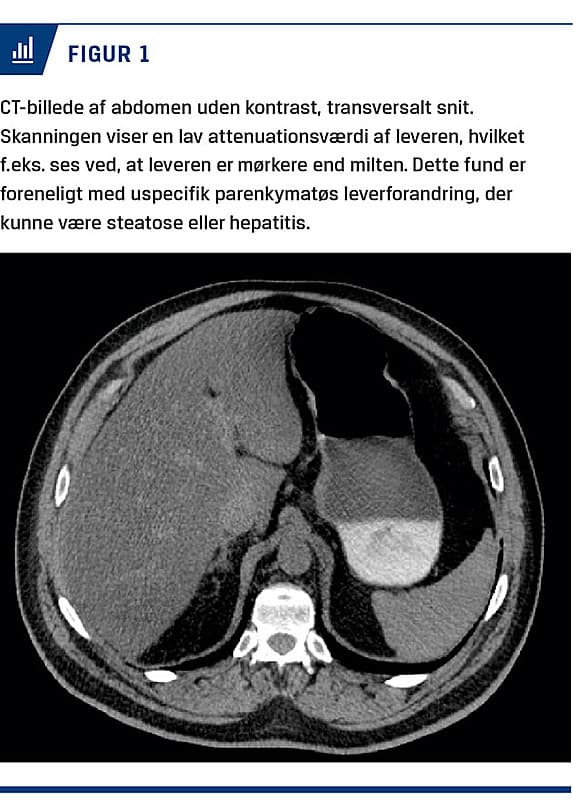 Røde gærris som formodet årsag til akut ­nyre- og leversvigt ...