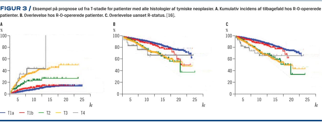 Behandling af tymom og thymuskarcinom | Ugeskriftet.dk