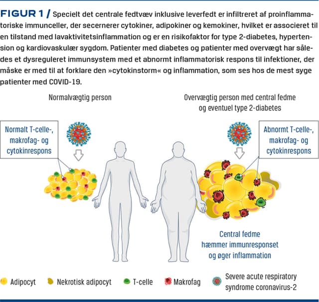 Den endokrine og metaboliske kobling mellem COVID-19, diabetes og fedme ...