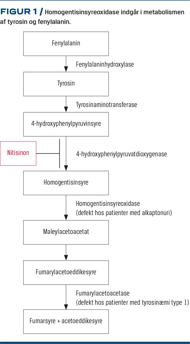 Alkaptonuri opdaget i forbindelse med knæalloplastik | Ugeskriftet.dk