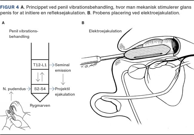 Andrologiske tilstande og deres behandling hos mænd med rygmarvsskade ...