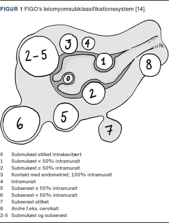 Kirurgisk behandling ved kvindelig infertilitet | Ugeskriftet.dk