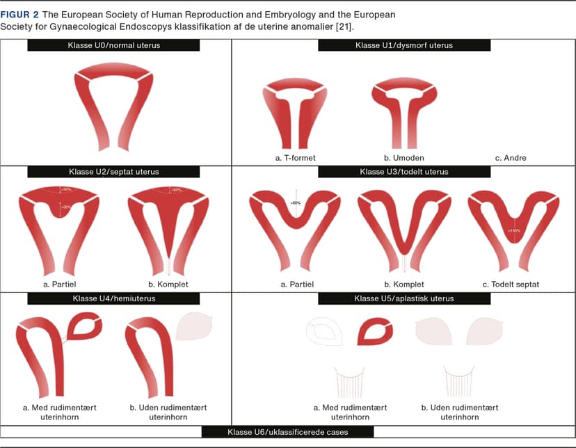 Kirurgisk behandling ved kvindelig infertilitet | Ugeskriftet.dk