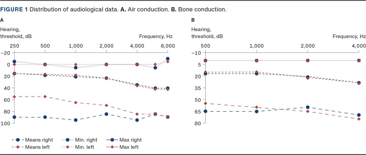 Validation of the Danish version ofthe Tinnitus Functional Index | Ugeskriftet.dk