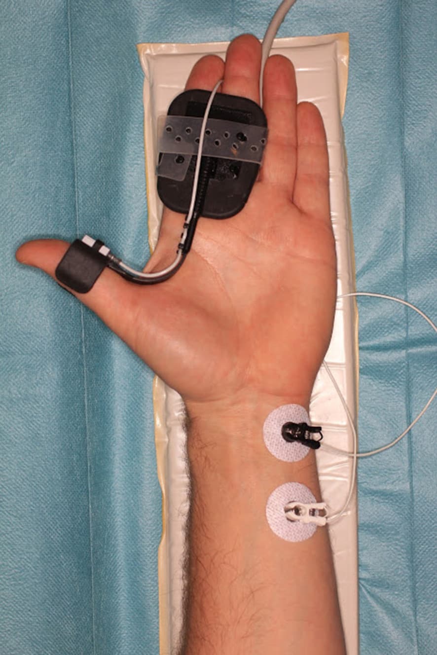 Shortened time to neuromuscular recovery with lower doses of rocuronium ...